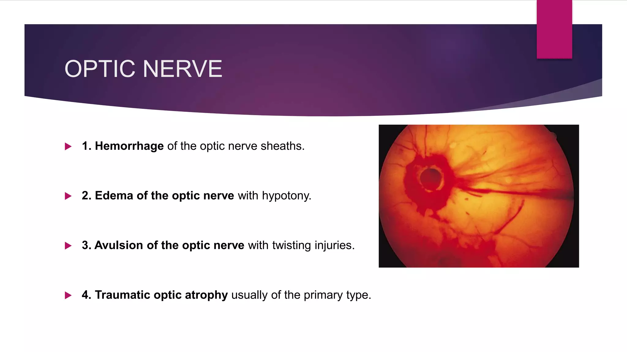 OCULAR TRAUMA - Classification of mechanical injuries, clinical ...