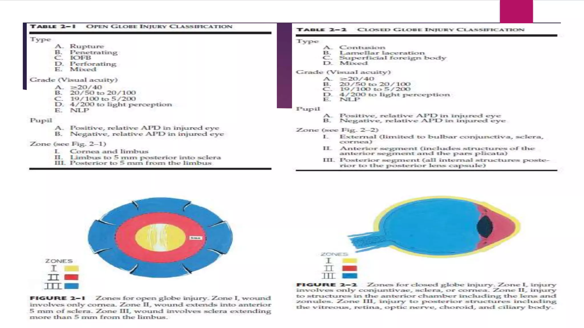 OCULAR TRAUMA - Classification of mechanical injuries, clinical ...