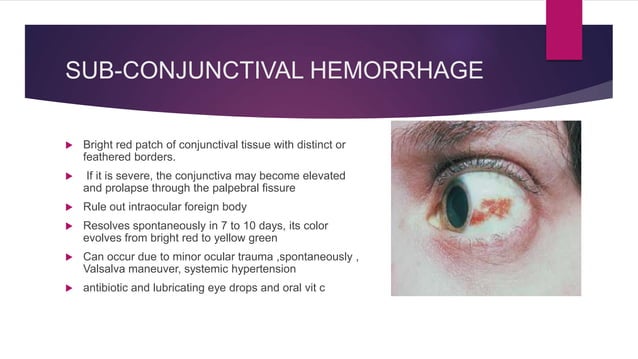 OCULAR TRAUMA - Classification of mechanical injuries, clinical ...