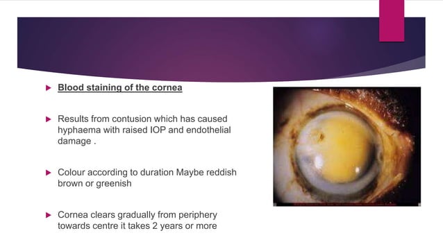 OCULAR TRAUMA - Classification of mechanical injuries, clinical ...