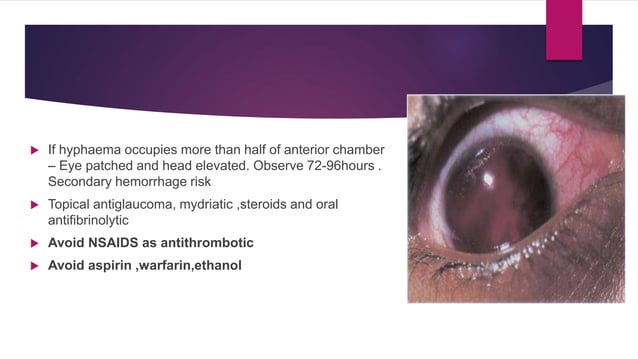 OCULAR TRAUMA - Classification of mechanical injuries, clinical ...