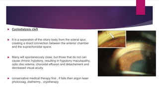 OCULAR TRAUMA - Classification of mechanical injuries, clinical ...