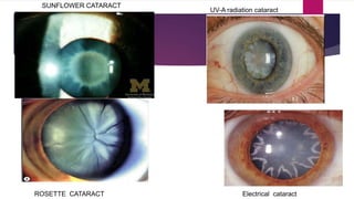 OCULAR TRAUMA - Classification of mechanical injuries, clinical ...