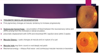 OCULAR TRAUMA - Classification of mechanical injuries, clinical ...