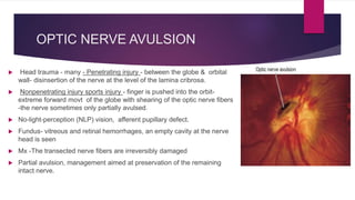 OCULAR TRAUMA - Classification of mechanical injuries, clinical ...
