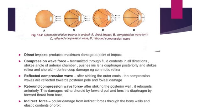 OCULAR TRAUMA - Classification of mechanical injuries, clinical ...