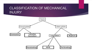 OCULAR TRAUMA - Classification of mechanical injuries, clinical ...