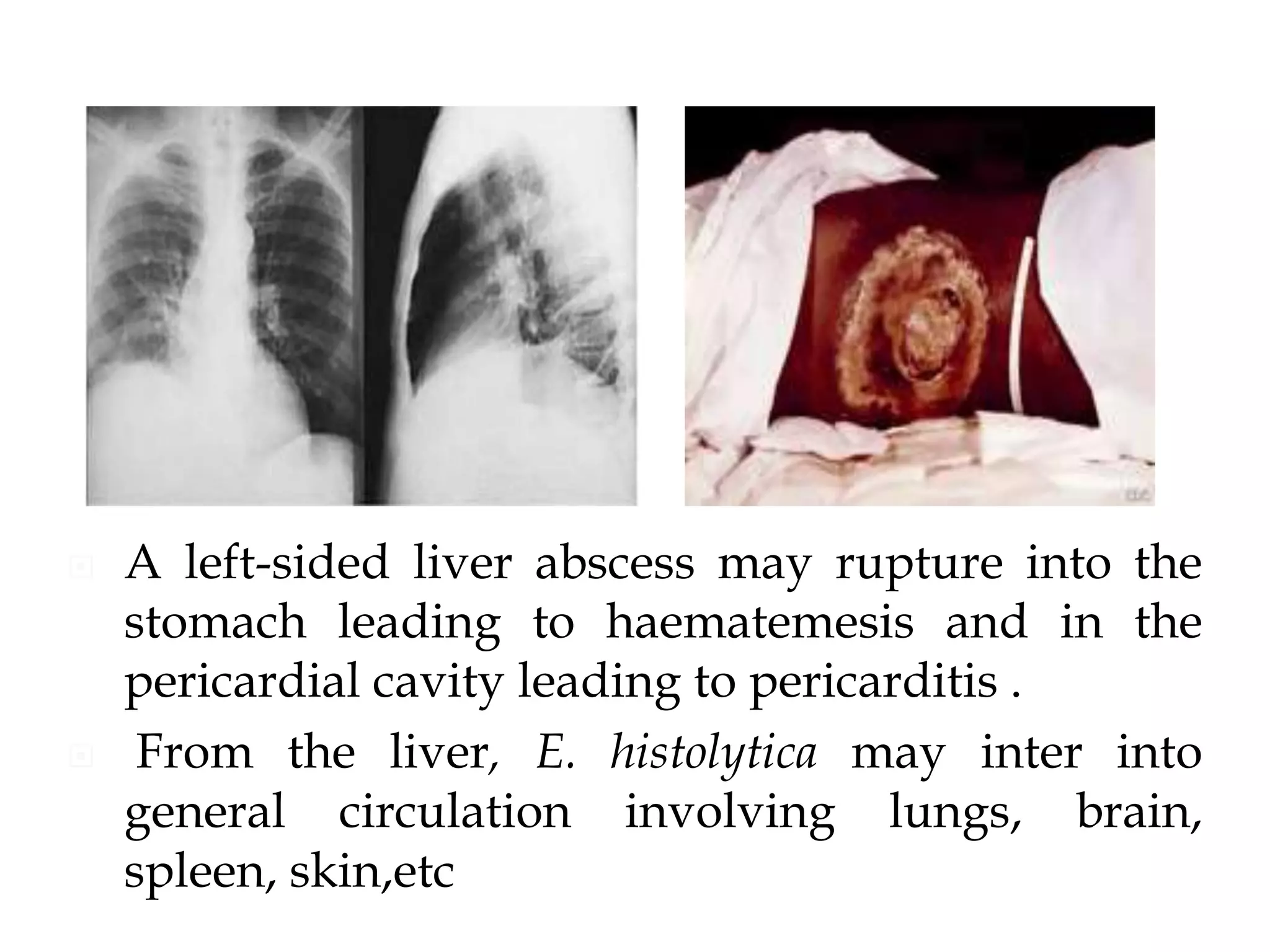 Classification of medical parasitology Lec.2.pptx