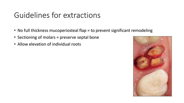 CLASSIFICATION Of molar extraction sites.pptx