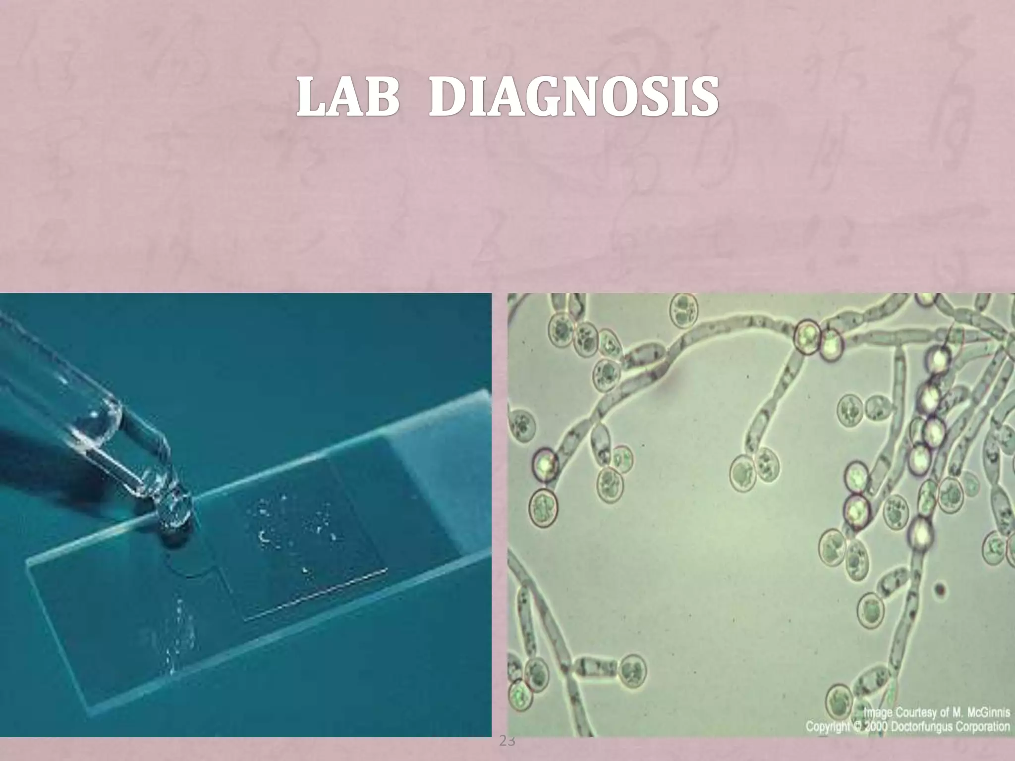Classification of Mycoses by Dr. Rakesh Prasad Sah | PPTX