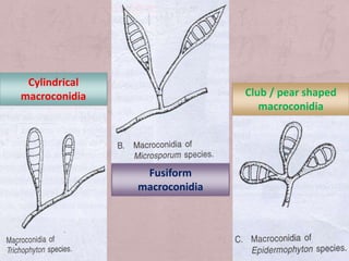 Classification of Mycoses by Dr. Rakesh Prasad Sah | PPTX