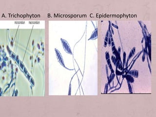 Classification of Mycoses by Dr. Rakesh Prasad Sah | PPTX