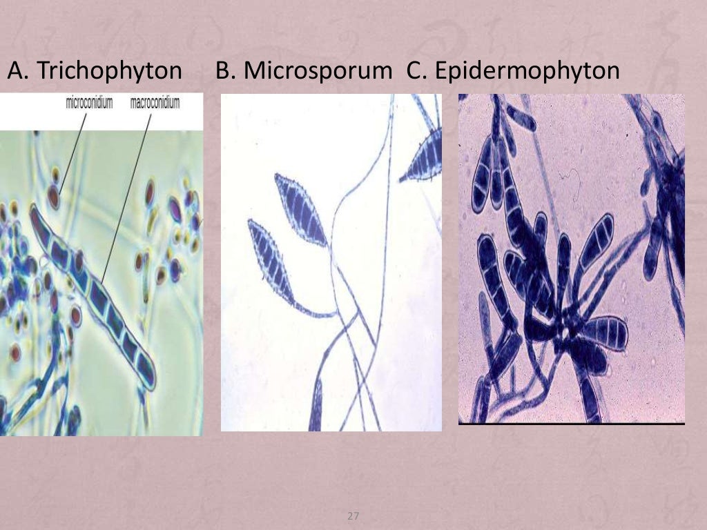 Classification of Mycoses by Dr. Rakesh Prasad Sah