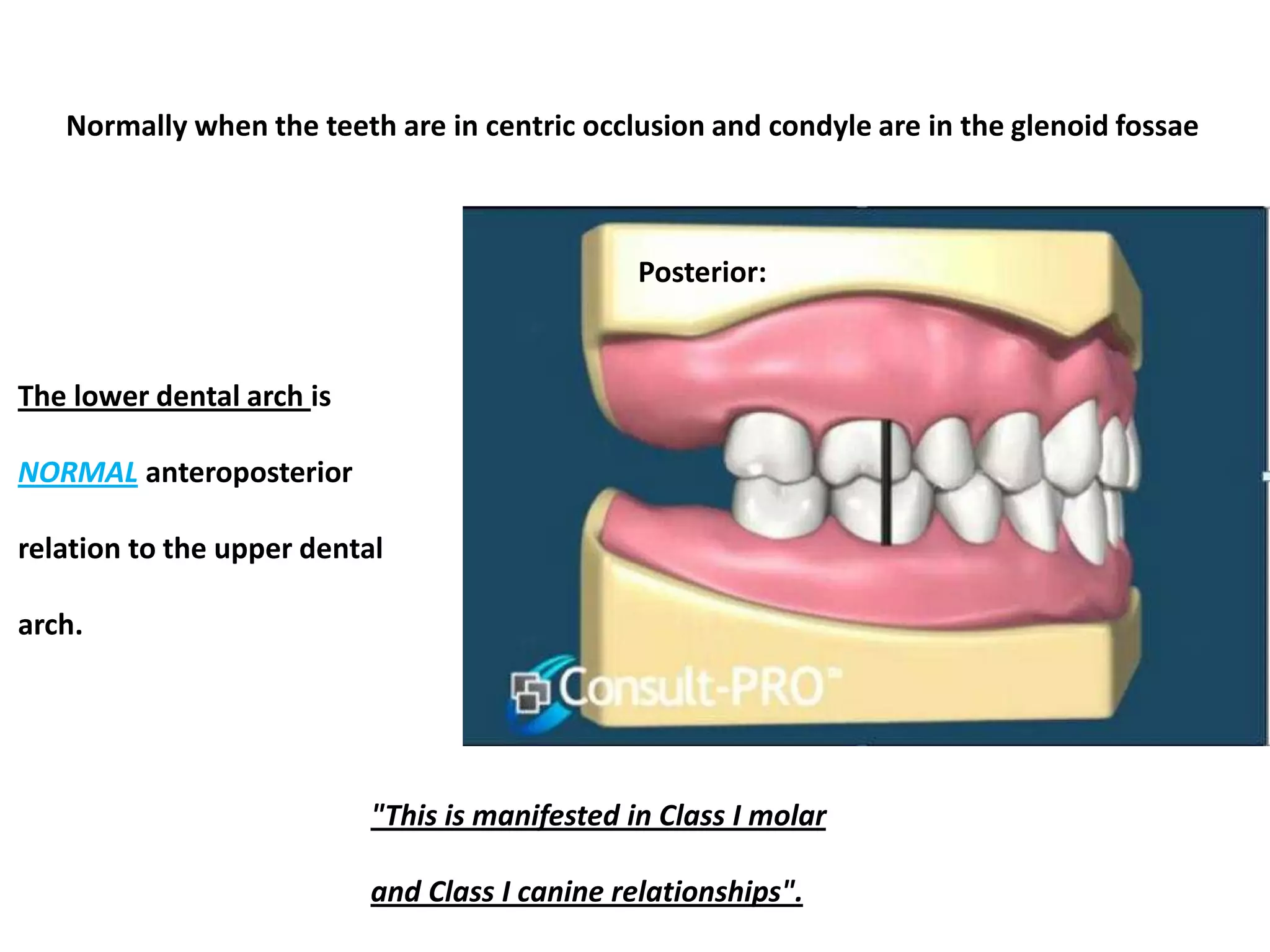 Classification of Occlusion and Malocclusion Dr. Nabil Al-Zubair | PDF