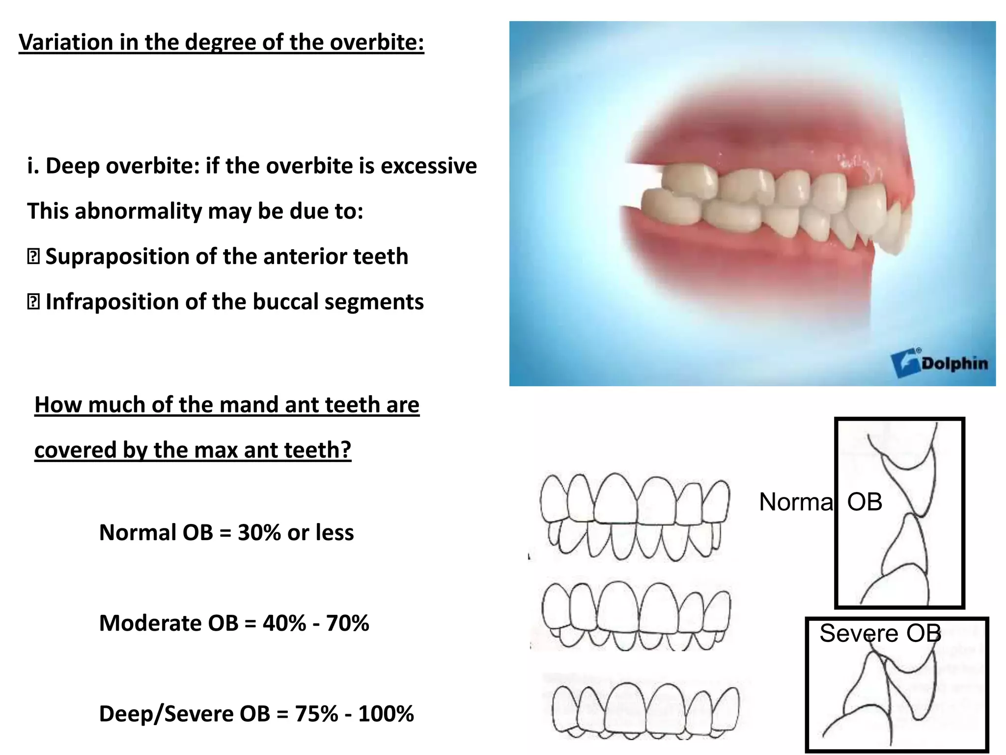 Classification of Occlusion and Malocclusion Dr. Nabil Al-Zubair | PDF