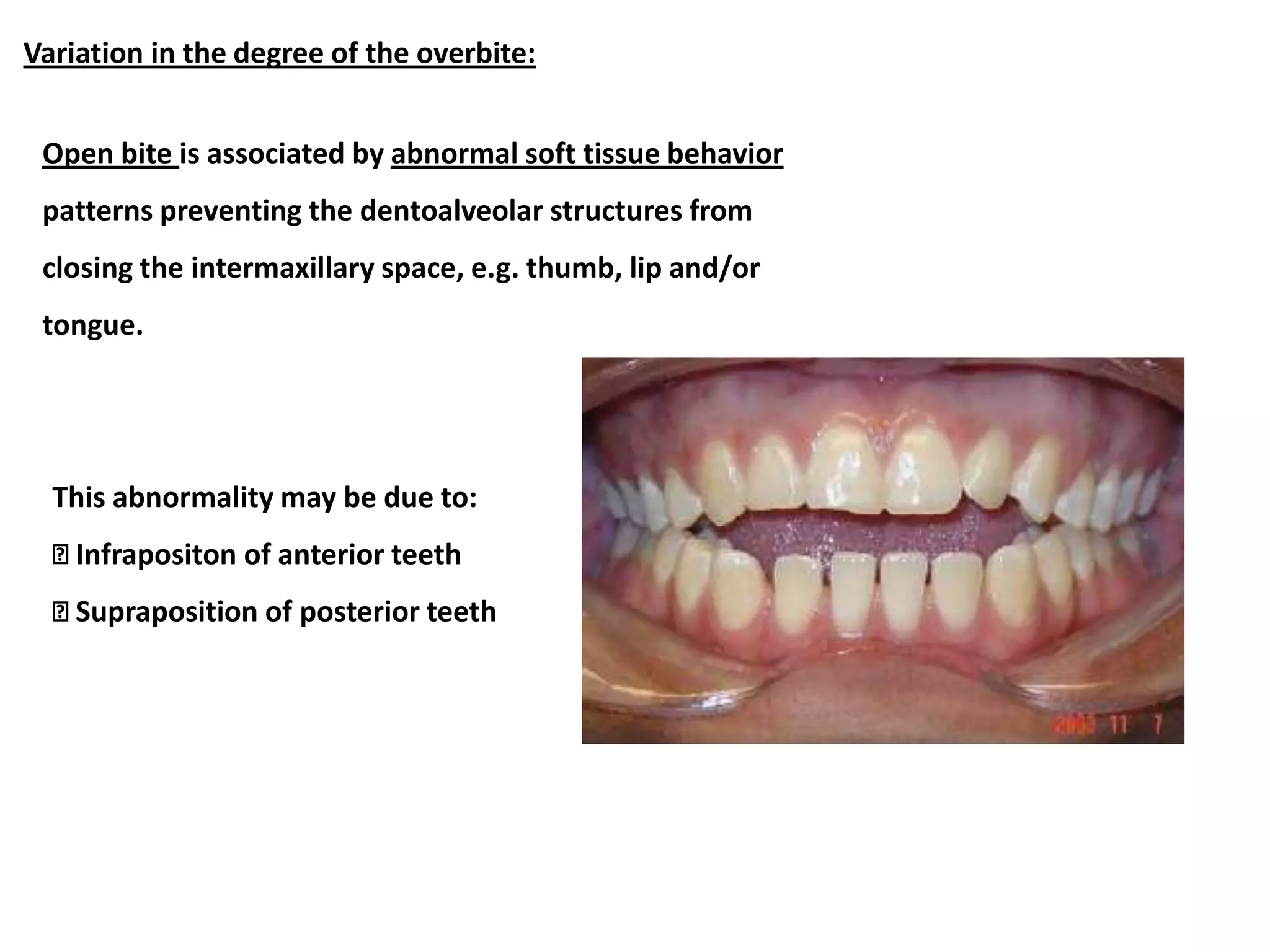 Classification Of Occlusion And Malocclusion Dr Nabil Al Zubair Pdf