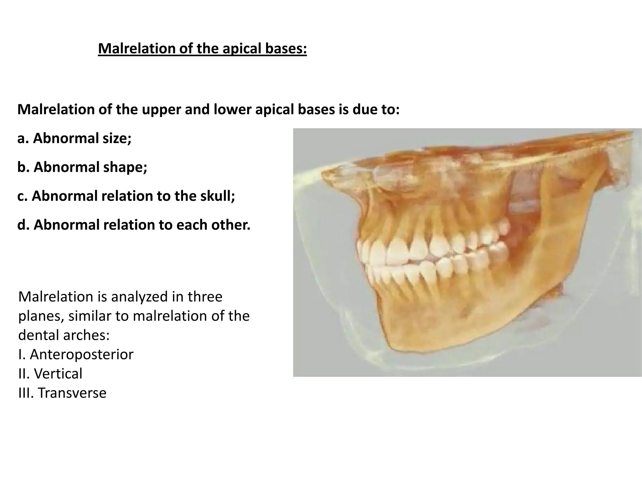 Classification of Occlusion and Malocclusion Dr. Nabil Al-Zubair | PDF