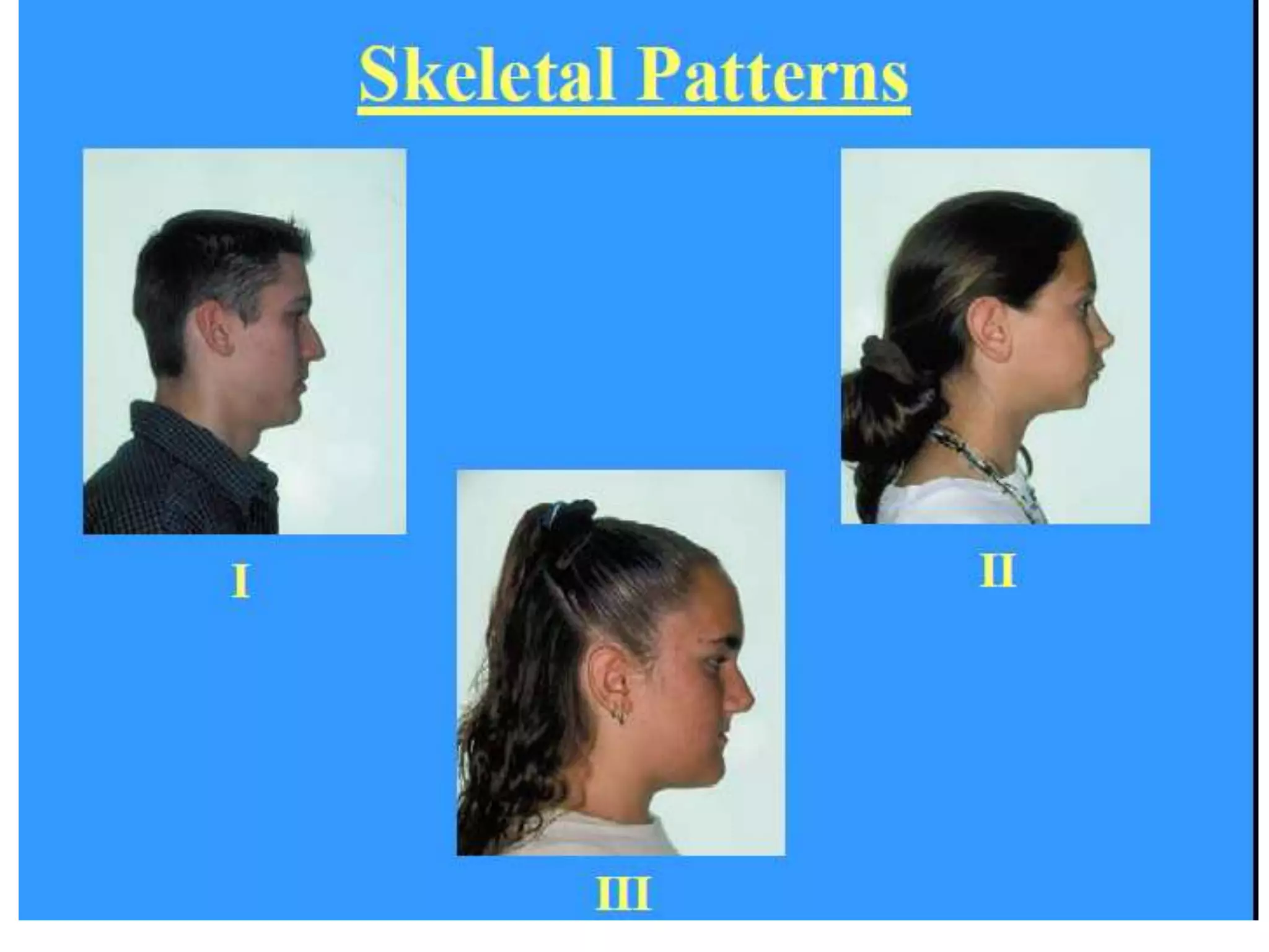 Classification of Occlusion and Malocclusion Dr. Nabil Al-Zubair | PDF