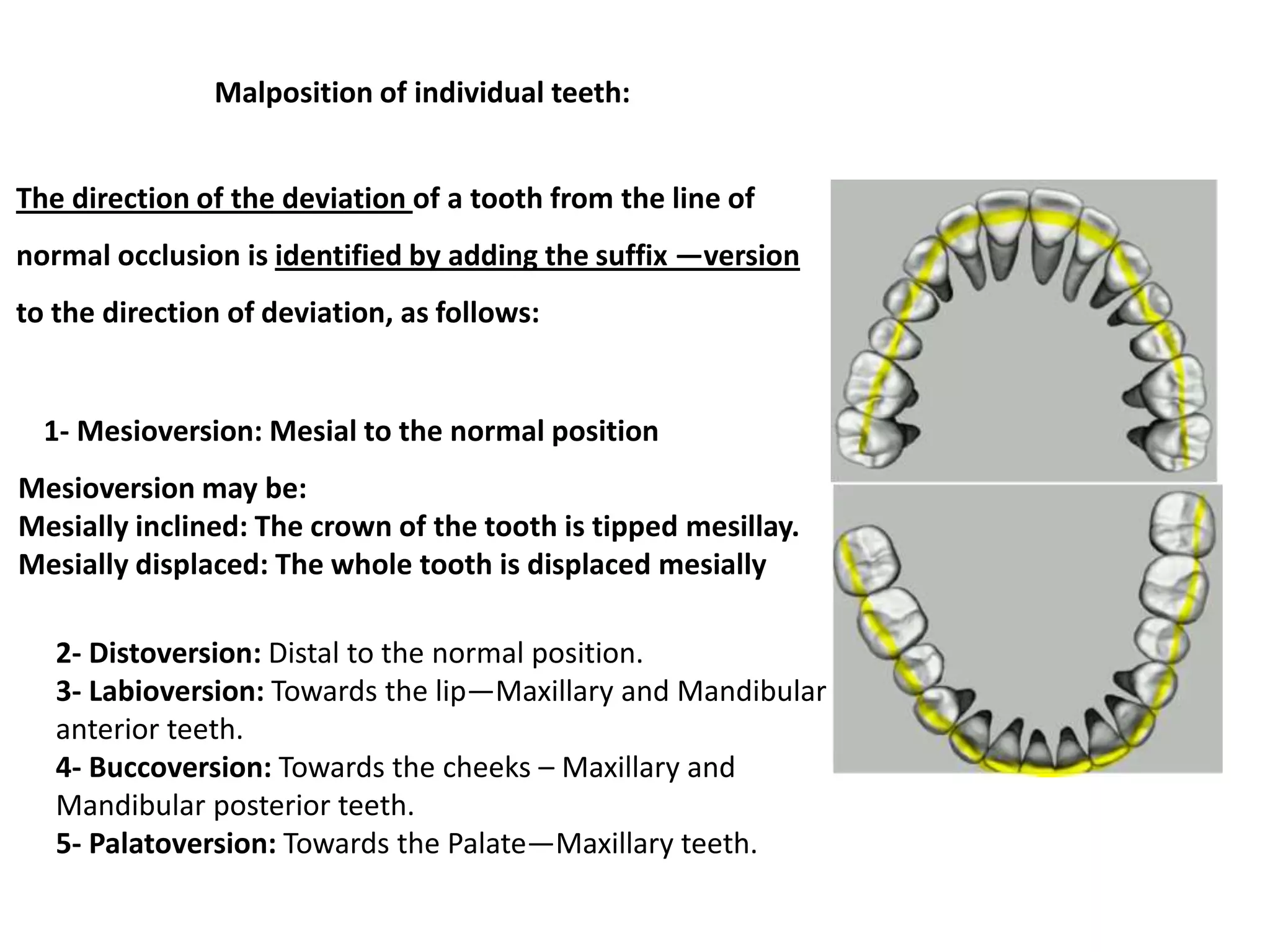 Classification Of Occlusion And Malocclusion Dr Nabil Al Zubair Ppt