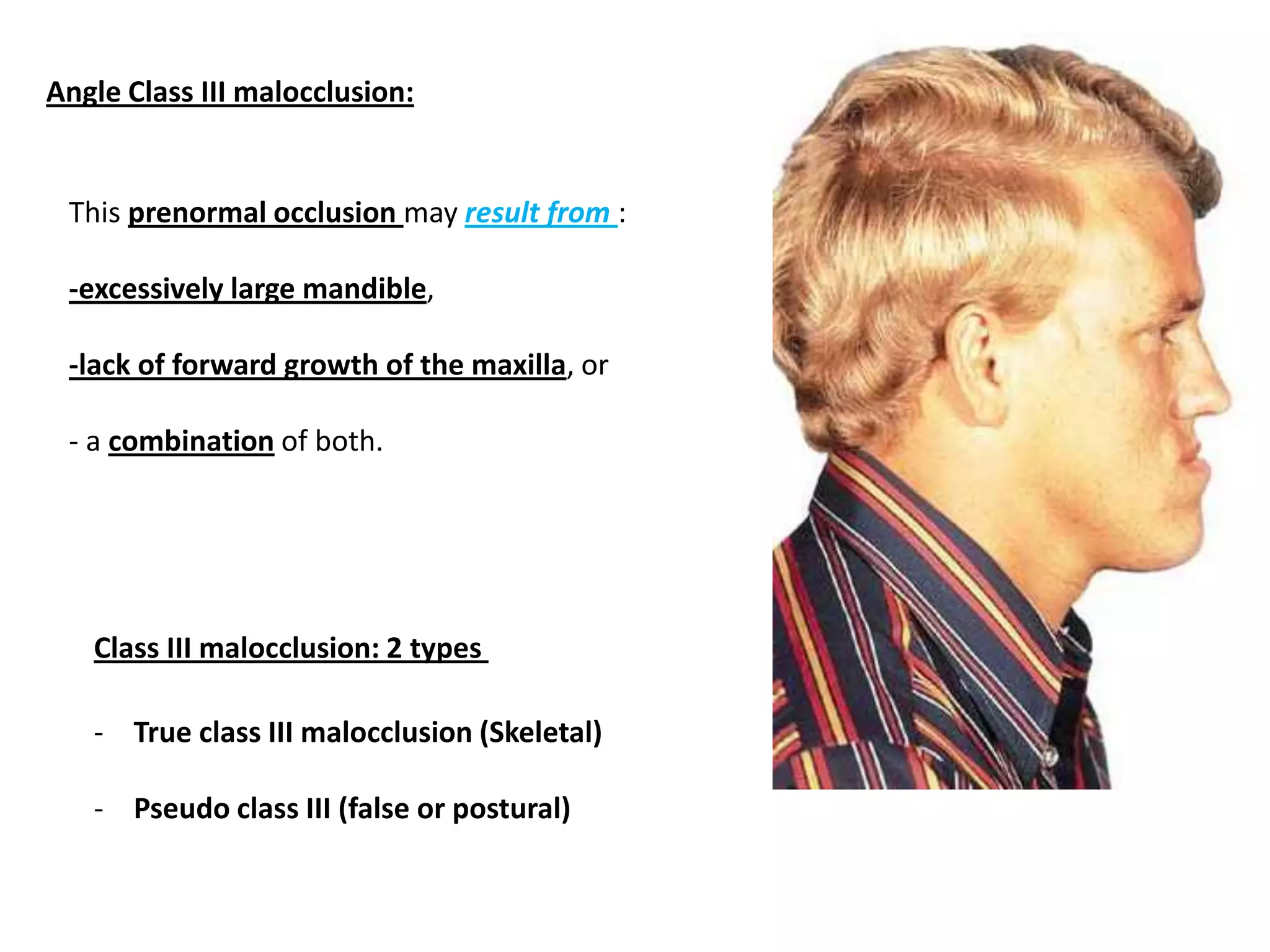 Classification of Occlusion and Malocclusion Dr. Nabil Al-Zubair | PDF