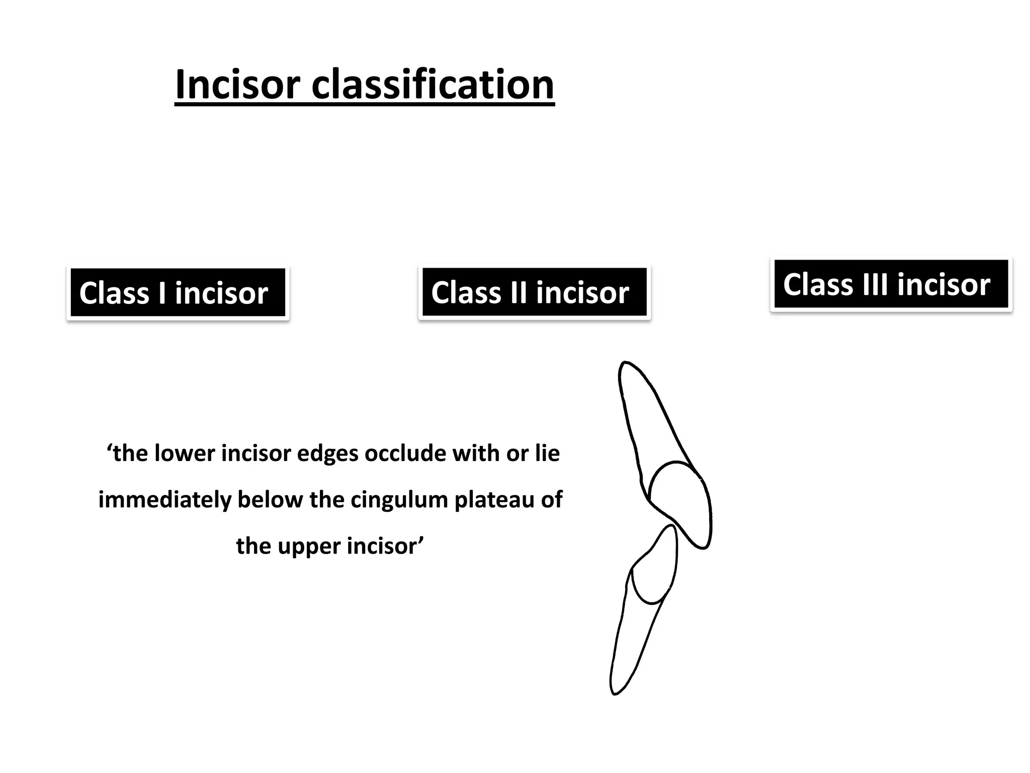 Classification of Occlusion and Malocclusion Dr. Nabil Al-Zubair | PDF
