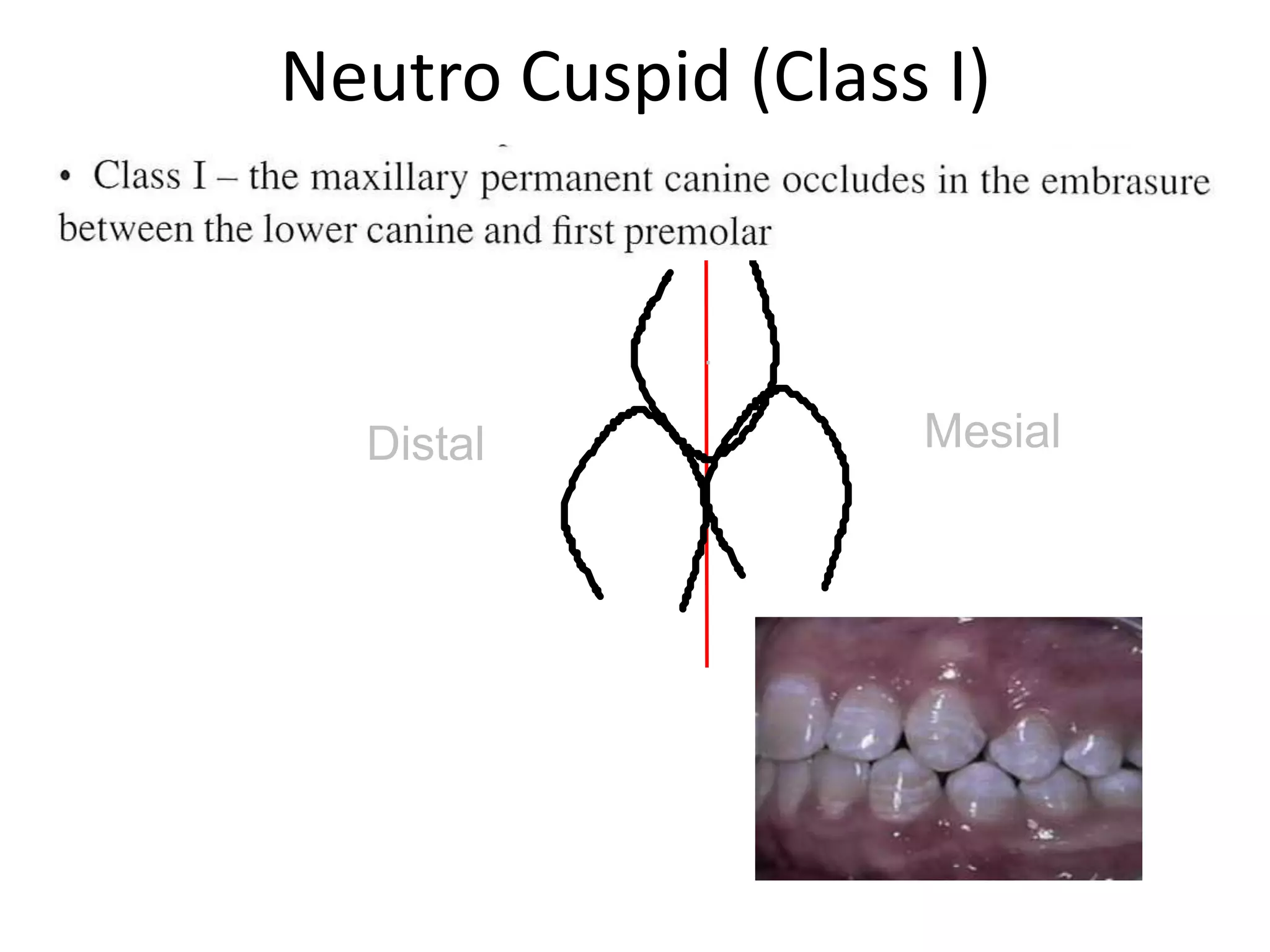 Classification of Occlusion and Malocclusion Dr. Nabil Al-Zubair | PDF
