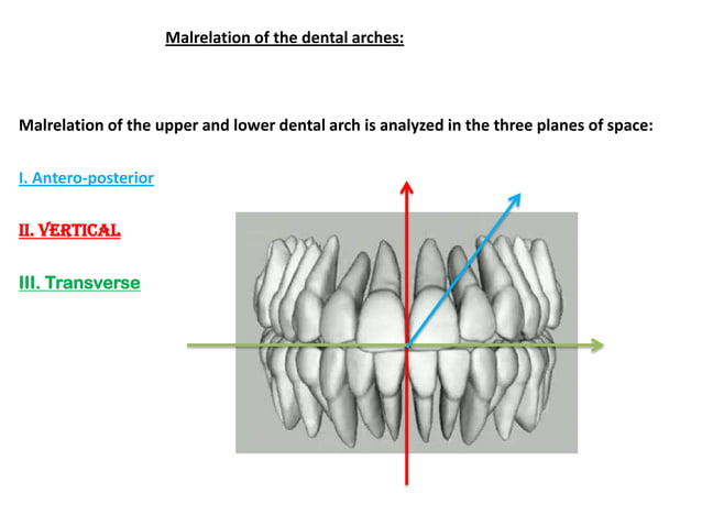 Classification of Occlusion and Malocclusion Dr. Nabil Al-Zubair | PDF