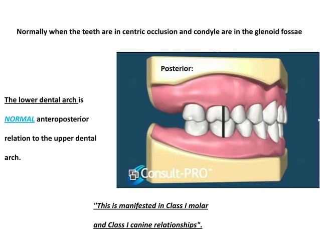 Classification of Occlusion and Malocclusion Dr. Nabil Al-Zubair | PDF