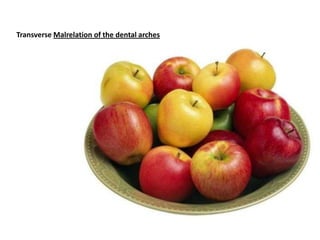 Classification of Occlusion and Malocclusion Dr. Nabil Al-Zubair | PDF