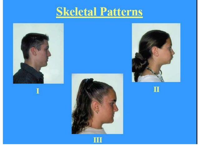 Classification of Occlusion and Malocclusion Dr. Nabil Al-Zubair | PDF