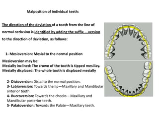 Classification of Occlusion and Malocclusion Dr. Nabil Al-Zubair | PDF