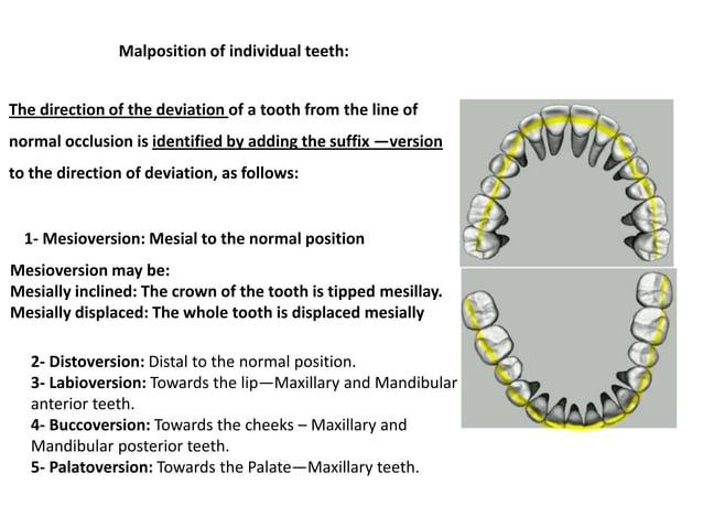 Classification of Occlusion and Malocclusion Dr. Nabil Al-Zubair | PDF