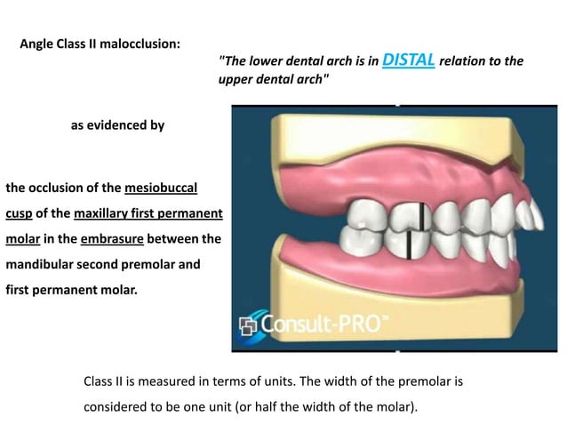 Classification of Occlusion and Malocclusion Dr. Nabil Al-Zubair