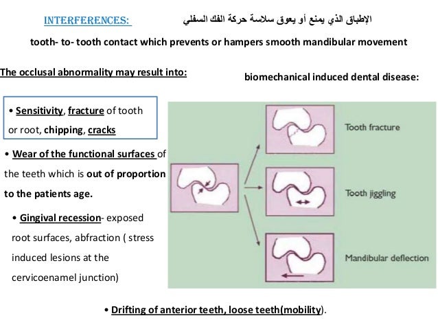 Classification of Occlusion and Malocclusion Dr. Nabil Al-Zubair