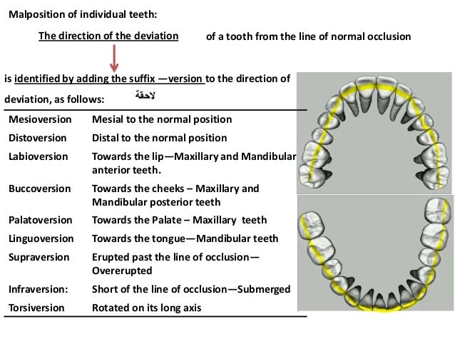 Classification of Occlusion and Malocclusion Dr. Nabil Al-Zubair