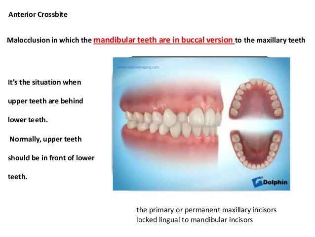 Classification of Occlusion and Malocclusion Dr. Nabil Al-Zubair