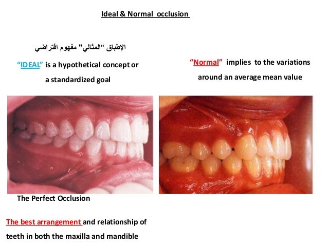 Classification of Occlusion and Malocclusion Dr. Nabil Al-Zubair