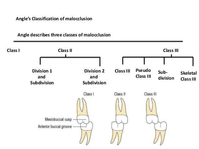 Classification of Occlusion and Malocclusion Dr. Nabil Al-Zubair