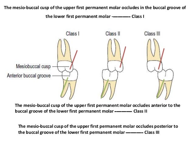 Classification of Occlusion and Malocclusion Dr. Nabil Al-Zubair