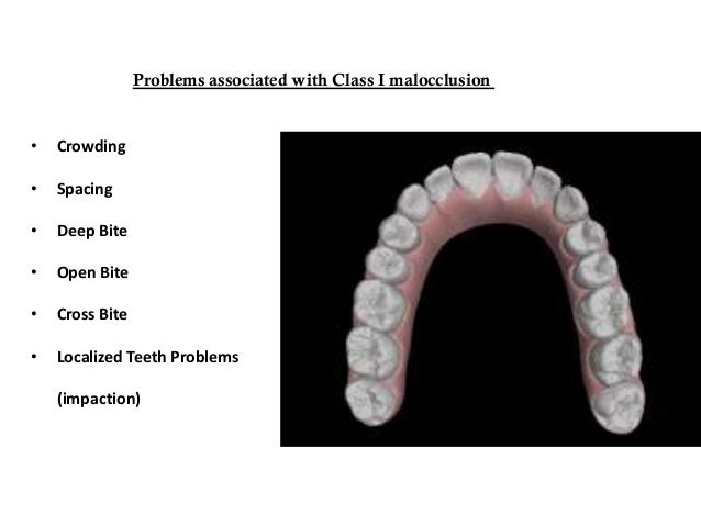 Classification of Occlusion and Malocclusion Dr. Nabil Al-Zubair