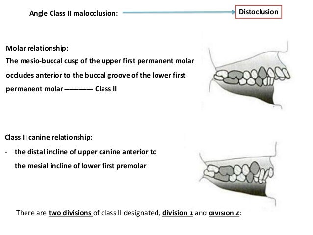 Classification of Occlusion and Malocclusion Dr. Nabil Al-Zubair