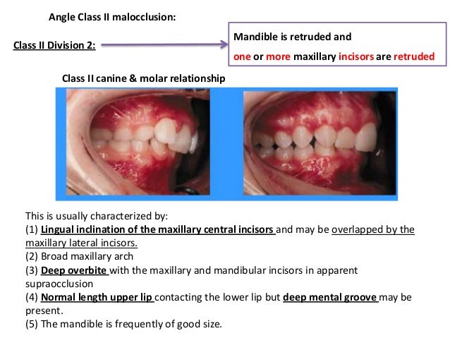 Classification of Occlusion and Malocclusion Dr. Nabil Al-Zubair