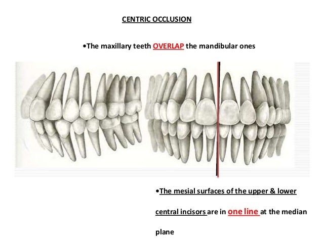 Classification of Occlusion and Malocclusion Dr. Nabil Al-Zubair