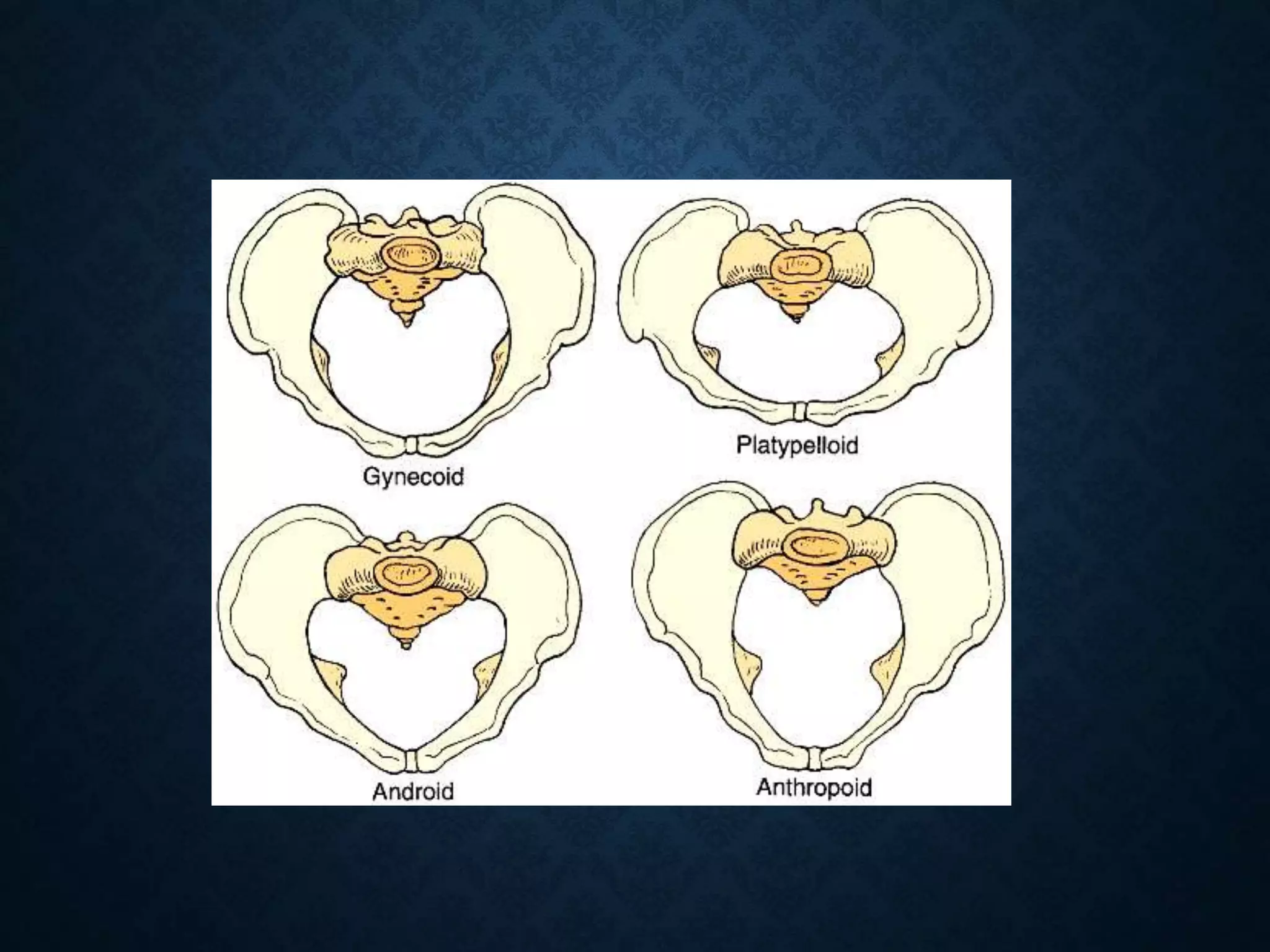 Classification of pelvis | PPTX