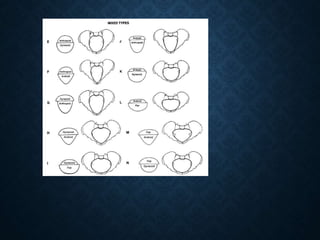 Classification of pelvis | PPTX