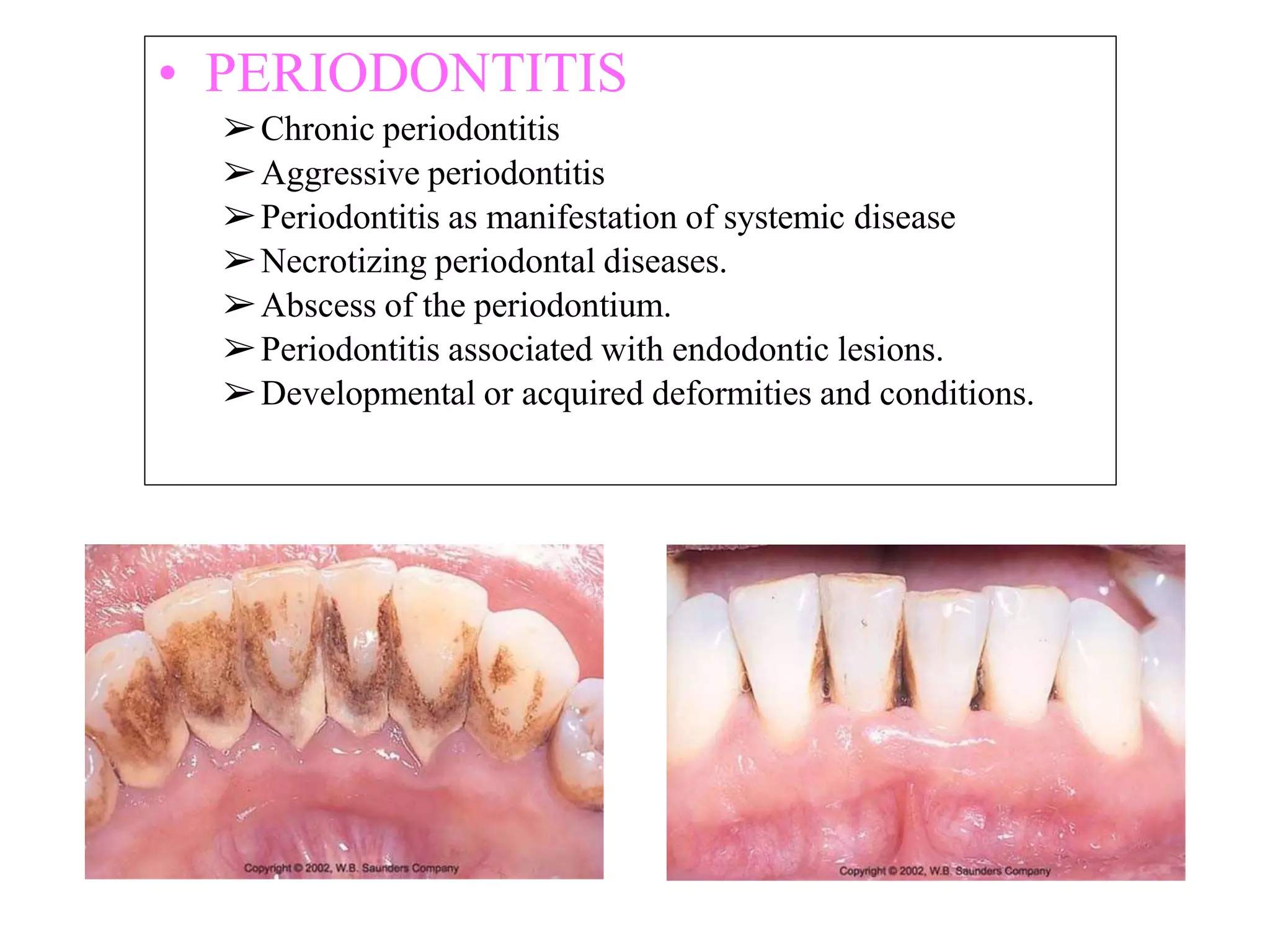 CLASSIFICATION OF PERIODONTAL DISEASE- DR JEEVANAND DESHMUKH.pptx