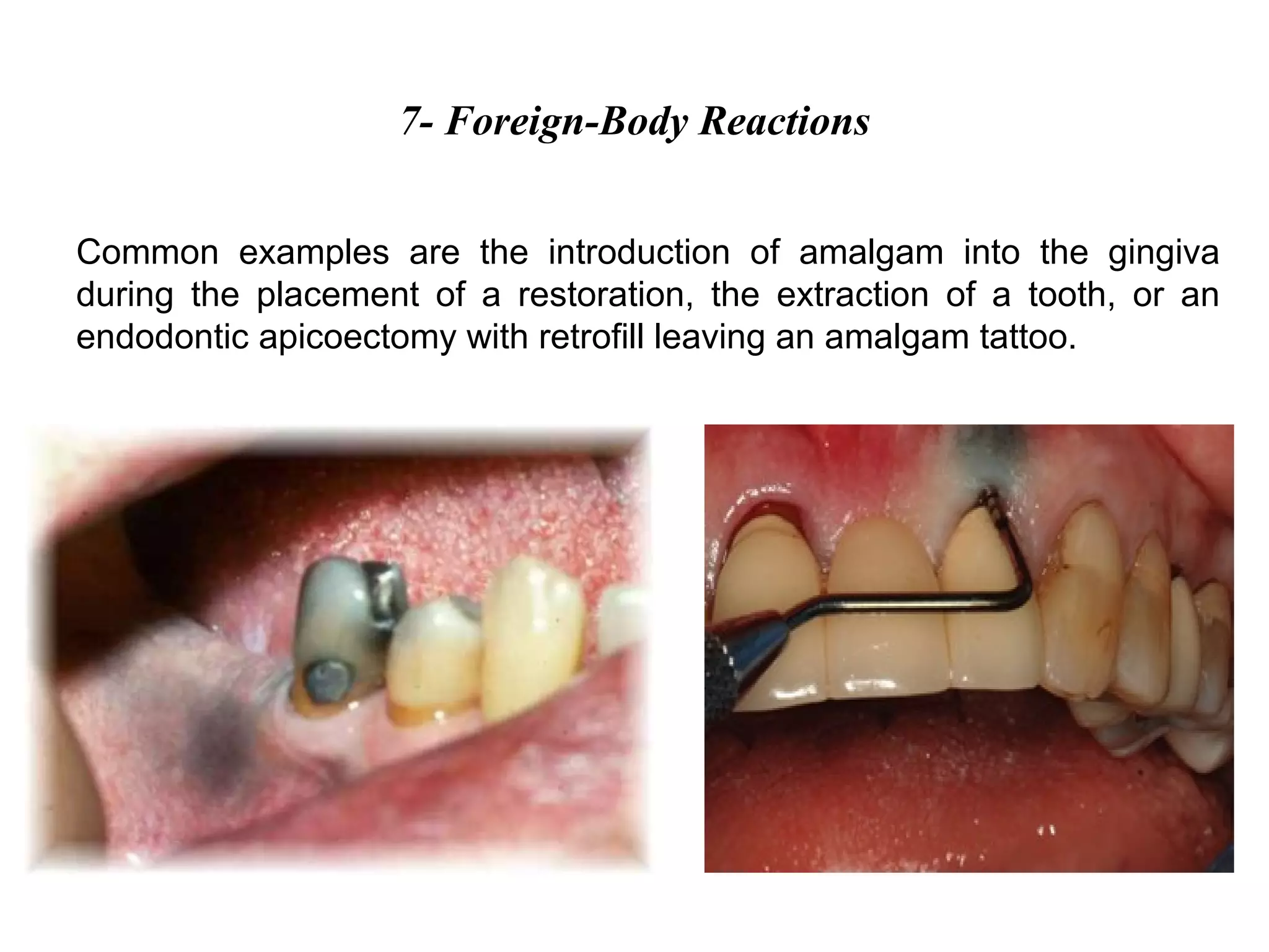 Classification of periodontal diseases | PPT