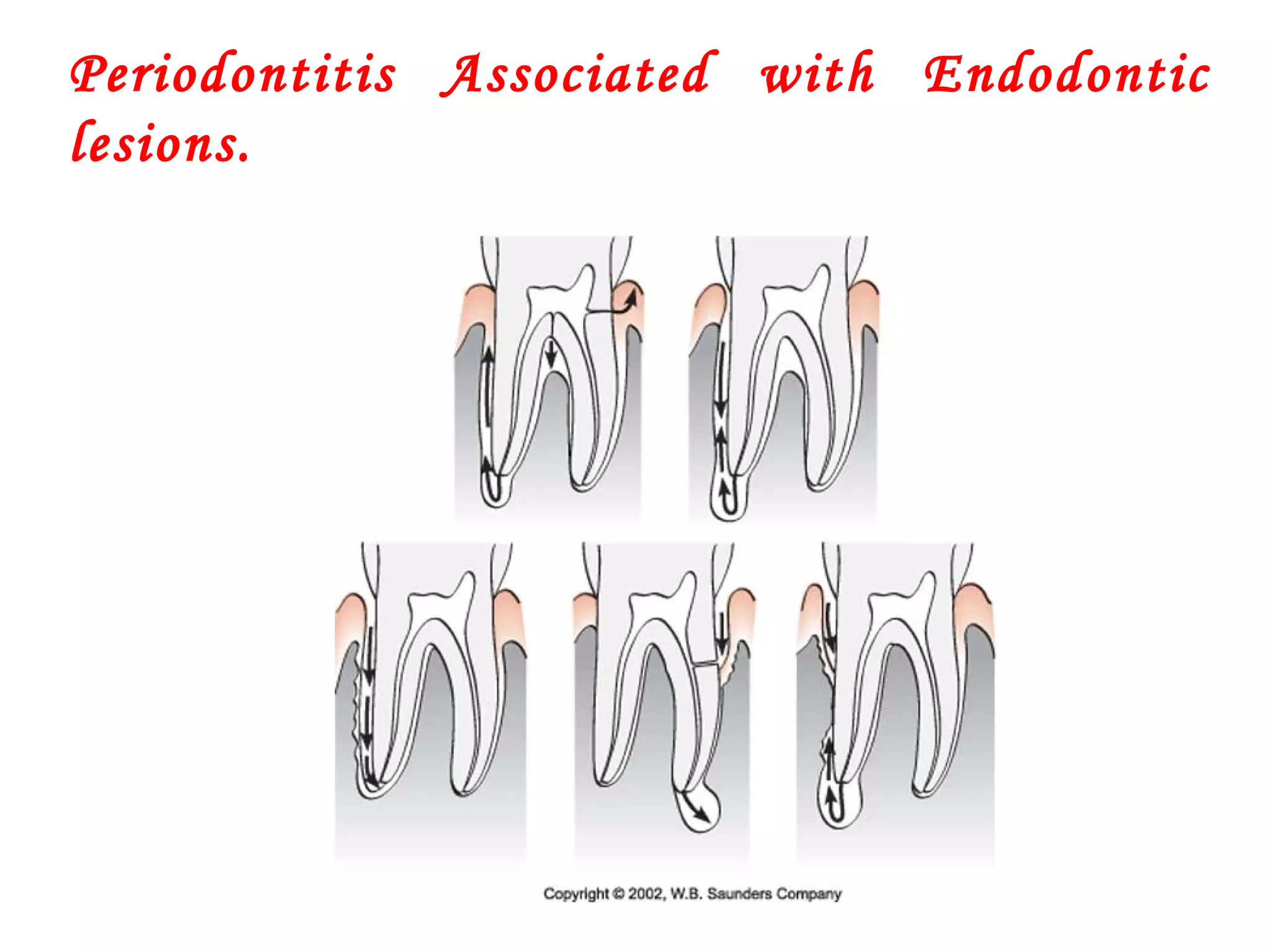 Classification of periodontal diseases | PPT