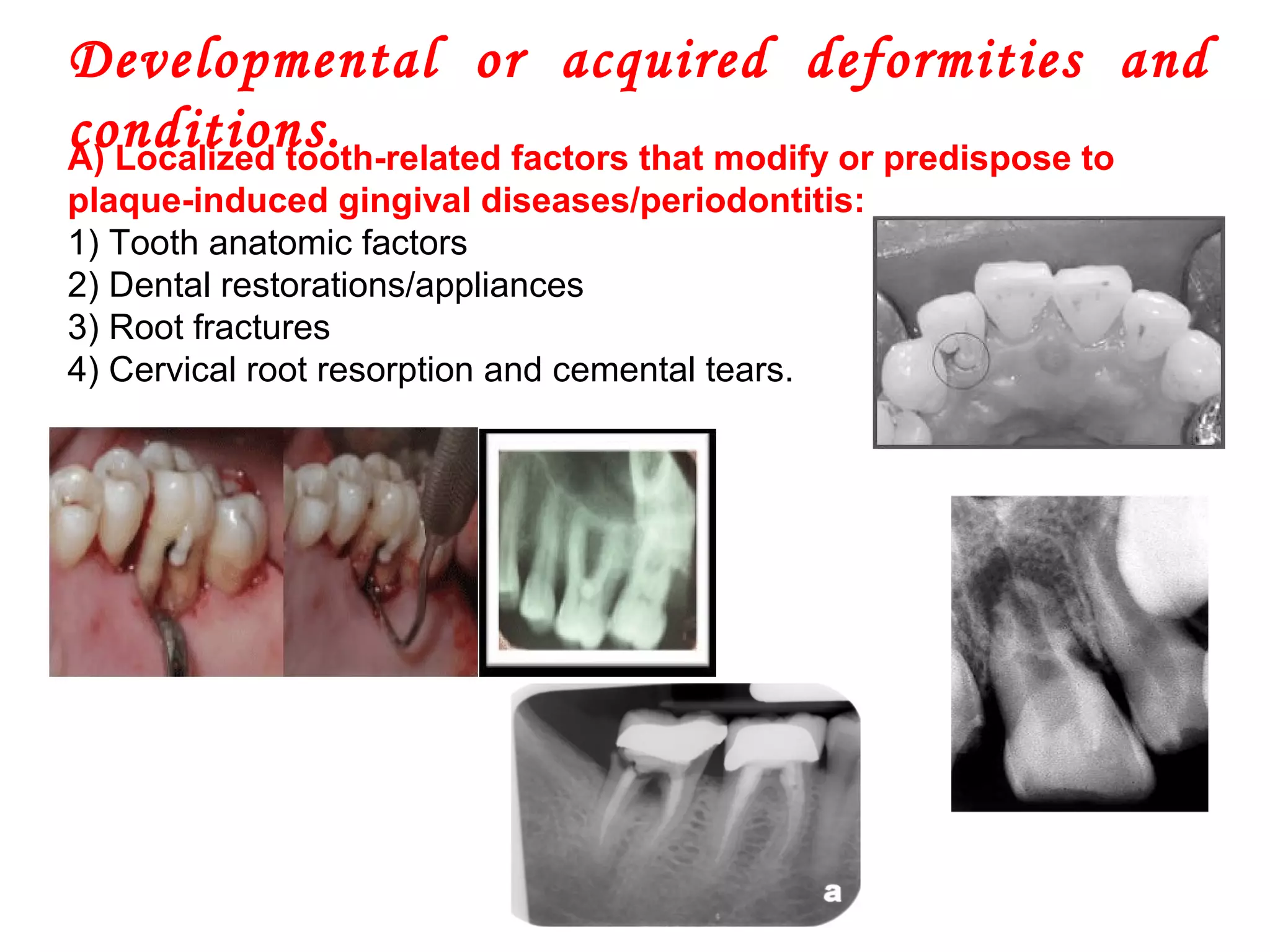 Classification of periodontal diseases | PPT