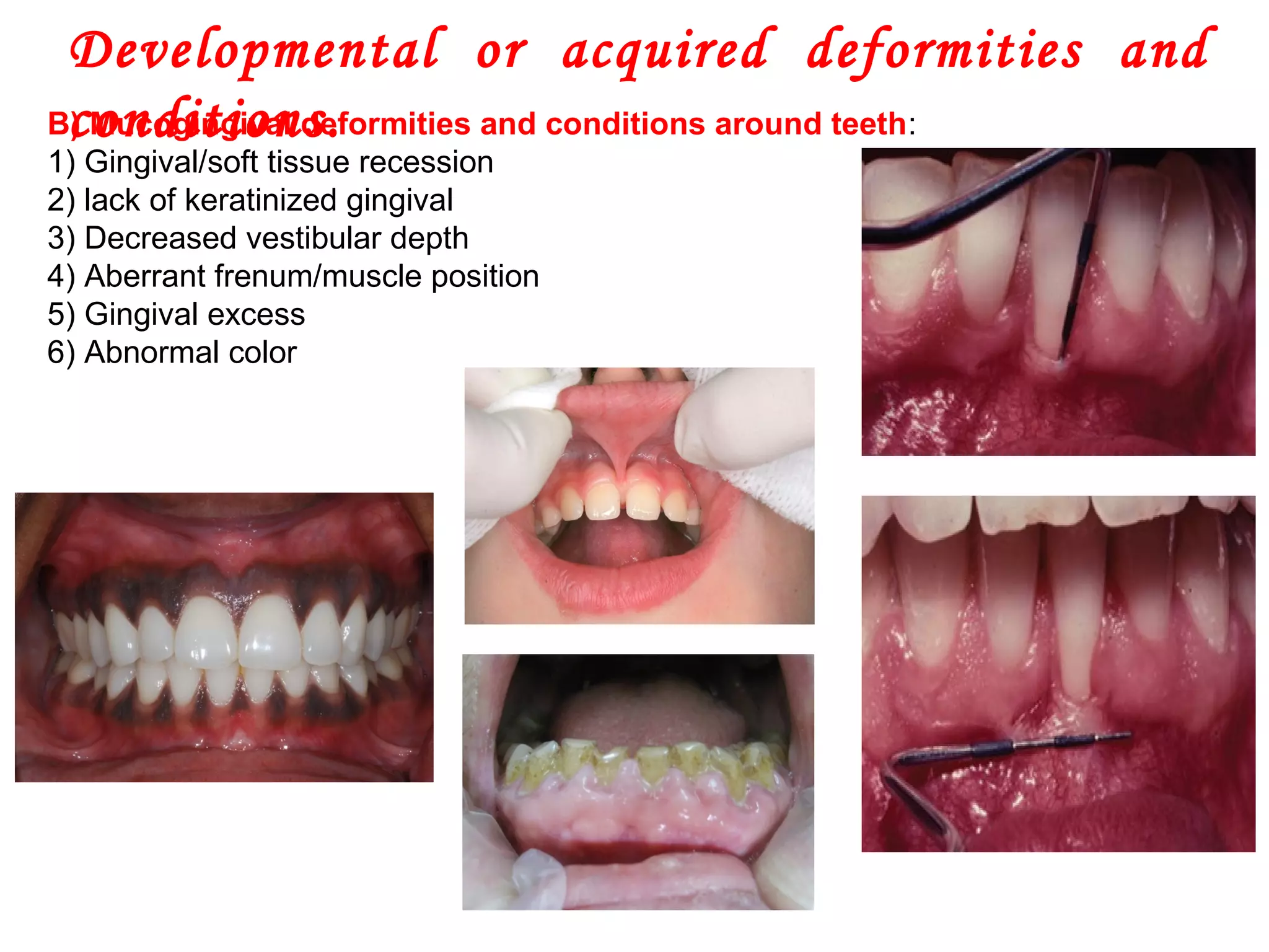 Classification of periodontal diseases | PPT